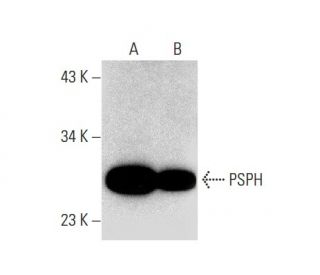PSPH Antibody (H-10) | SCBT - Santa Cruz Biotechnology