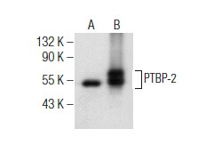 Anti-PTBP-2 Antibody (A-10) | SCBT - Santa Cruz Biotechnology