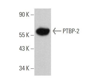 Anti-PTBP-2 Antibody (A-10) | SCBT - Santa Cruz Biotechnology