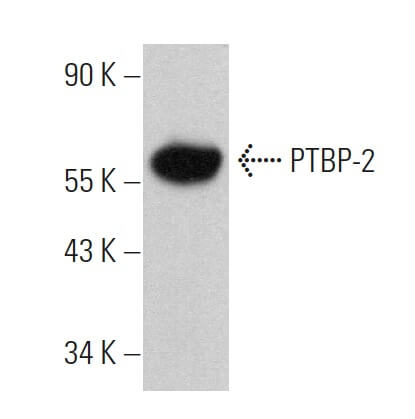 Anti-PTBP-2 Antibody (A-10) | SCBT - Santa Cruz Biotechnology