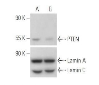 PTEN siRNA (h), shRNA and Lentiviral Particle Gene Silencers | SCBT ...