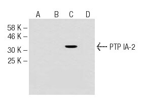 Anti-PTP IA-2 Antibody (AFT38) | SCBT - Santa Cruz Biotechnology