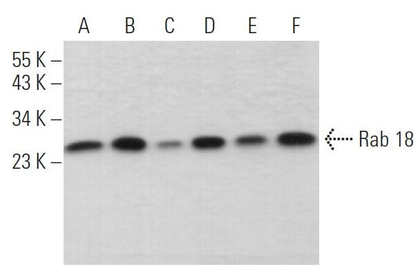 Rab 18 Antibody (D-5) | SCBT - Santa Cruz Biotechnology