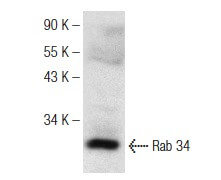 Anti-Rab 34 Antibody (E-10) | SCBT - Santa Cruz Biotechnology