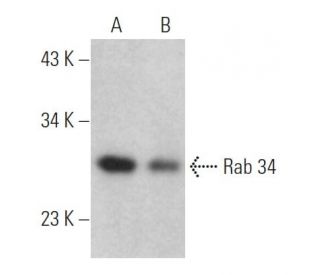 Anti-Rab 34 Antibody (E-10) | SCBT - Santa Cruz Biotechnology