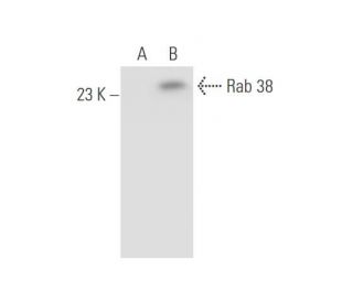 Rab 38 Antibody (11B-7) | SCBT - Santa Cruz Biotechnology