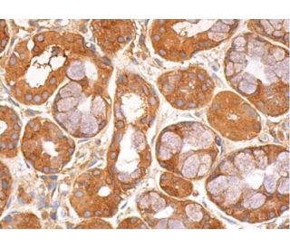 Anti-Rab 4A Antibody (4E11) | SCBT - Santa Cruz Biotechnology