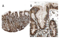 Rab 5 Antibody (D-11) | SCBT - Santa Cruz Biotechnology