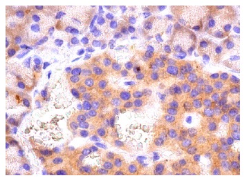 Rab 5 Antibody (D-11) | SCBT - Santa Cruz Biotechnology