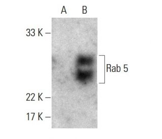 Rab 5 Antibody (D-11) | SCBT - Santa Cruz Biotechnology