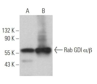 Anti-Rab GDI α/β Antibody (E-5) | SCBT - Santa Cruz Biotechnology