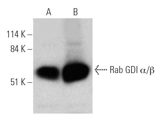 Rab GDI α/β Antibody (E-5) | SCBT - Santa Cruz Biotechnology
