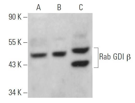 Rab GDI β Antibody (D-2) | SCBT - Santa Cruz Biotechnology