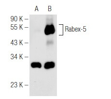 Anti-Rabex-5 Antibody (D-11) | SCBT - Santa Cruz Biotechnology