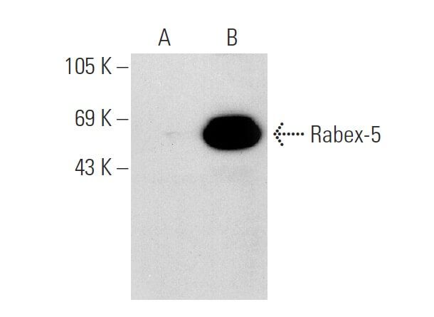 Rabex-5 Antibody (D-8) | SCBT - Santa Cruz Biotechnology