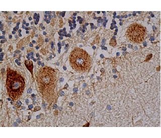 RACK1 Antibody (B-3) - Immunohistochemistry - Image 363339
