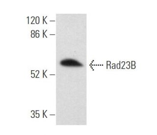 Rad23B Antibody (E-10) - Western Blotting - Image 372389
