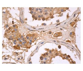 Anti-Rad51 Antibody (3C10) | SCBT - Santa Cruz Biotechnology
