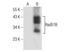 Rad51B Antibody (D-12) | SCBT - Santa Cruz Biotechnology