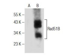 Rad51B Antibody (F-12) | SCBT - Santa Cruz Biotechnology