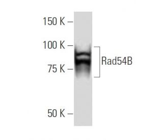 Rad54B Antibody (19-K2) - Western Blotting - Image 34593