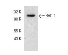 RAG-1 Antibody (D-5) | SCBT - Santa Cruz Biotechnology