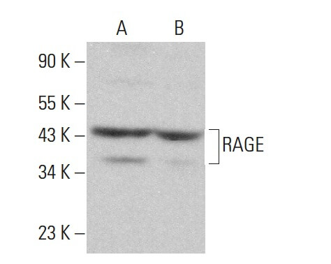 Anti-RAGE Antibody (A-9) | SCBT - Santa Cruz Biotechnology