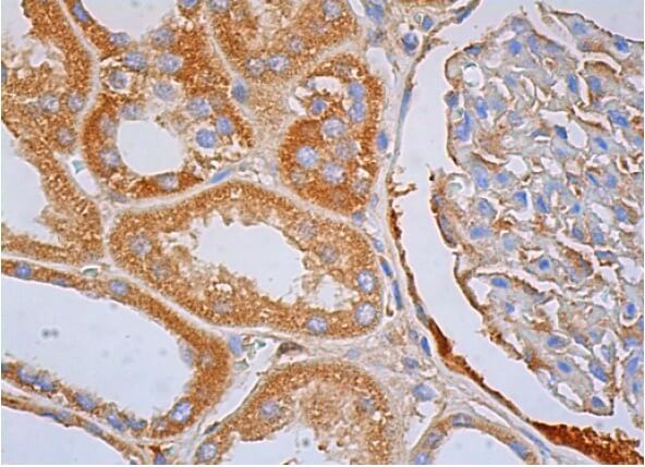 Anti-Rak Antibody (H-12) | SCBT - Santa Cruz Biotechnology