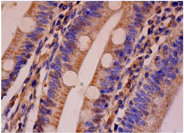 Ral A抗体 (F-5) | SCBT - Santa Cruz Biotechnology