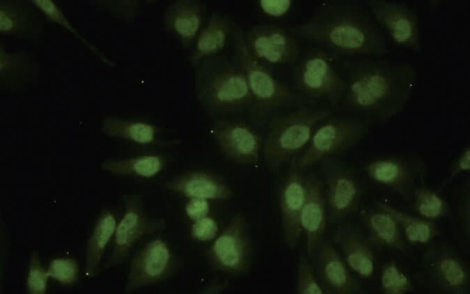 Anti-Ral GPS2 Antibody (FE-63) | SCBT - Santa Cruz Biotechnology