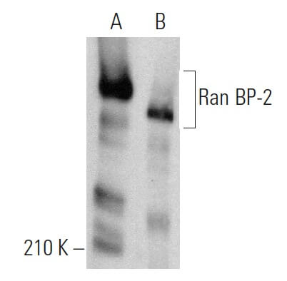 Anti-Ran BP-2 Antibody (D-4) | SCBT - Santa Cruz Biotechnology