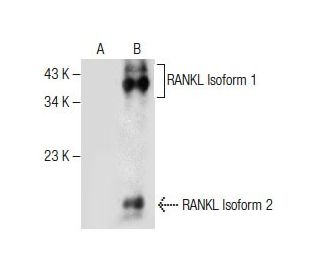 RANKL Antibody (G-1) - Western Blotting - Image 281255