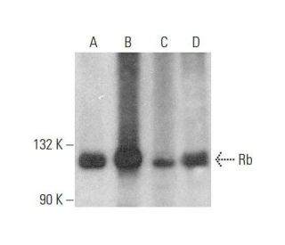 Rb Antibody (Rb1) - Western Blotting - Image 350688