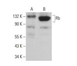 Rb Antibody (Rb1) - Western Blotting - Image 380857