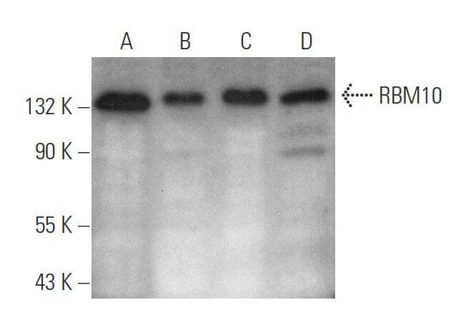 RBM10 Antibody (H-4) | SCBT - Santa Cruz Biotechnology