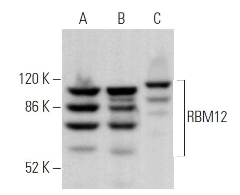 Anti-RBM12 Antibody (E-6) | SCBT - Santa Cruz Biotechnology