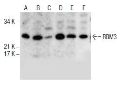 RBM3 Antibody (A-7) | SCBT - Santa Cruz Biotechnology