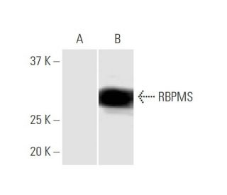 RBPMS Antibody (1C12) - Western Blotting - Image 347610