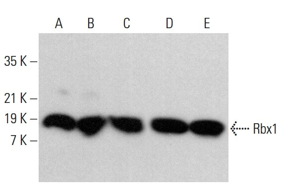 Rbx1 Antibody (E-11) | SCBT - Santa Cruz Biotechnology