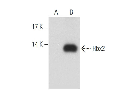 Anti-Rbx2 Antibody (G-8) | SCBT - Santa Cruz Biotechnology