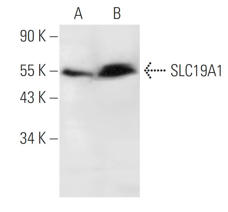 Anti-SLC19A1 Antibody (D-4) | SCBT - Santa Cruz Biotechnology
