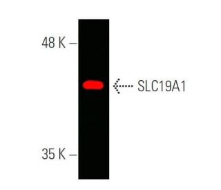 SLC19A1 Antibody (D-6) - Western Blotting - Image 391237