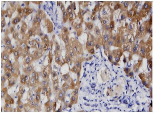 RGMc Antibody (1C12) | SCBT - Santa Cruz Biotechnology