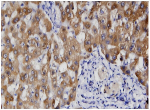 Anti-RGMc Antibody (1C12) | SCBT - Santa Cruz Biotechnology