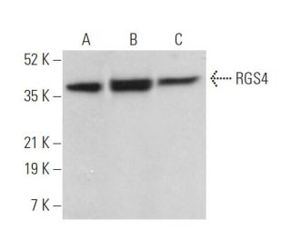 Anti-RGS4 Antibody (H-12) | SCBT - Santa Cruz Biotechnology