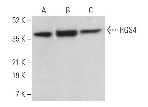 RGS4 Antibody (H-12) | SCBT - Santa Cruz Biotechnology
