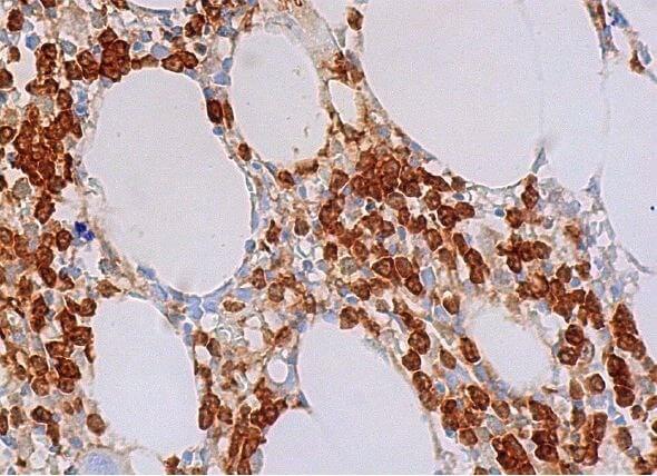 Anti-Rho GDI Antibody (G-3) | SCBT - Santa Cruz Biotechnology