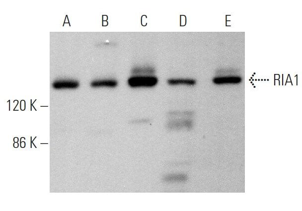 RIA1 Antibody (A-7) | SCBT - Santa Cruz Biotechnology