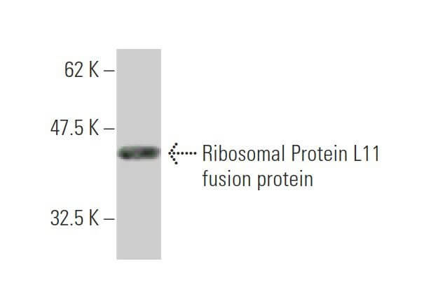 Ribosomal Protein L11 Antibody (2A1) | SCBT - Santa Cruz Biotechnology