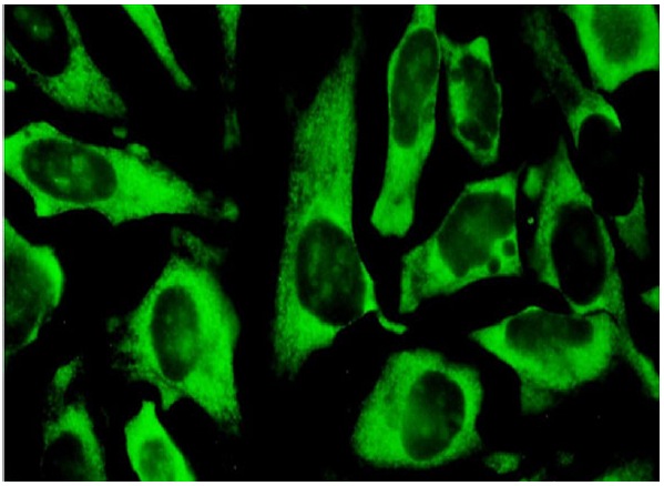 Ribosomal Protein LP0 Antibody (1B4) | SCBT - Santa Cruz Biotechnology